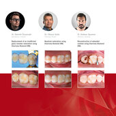 Charisma ONE Cases brochure